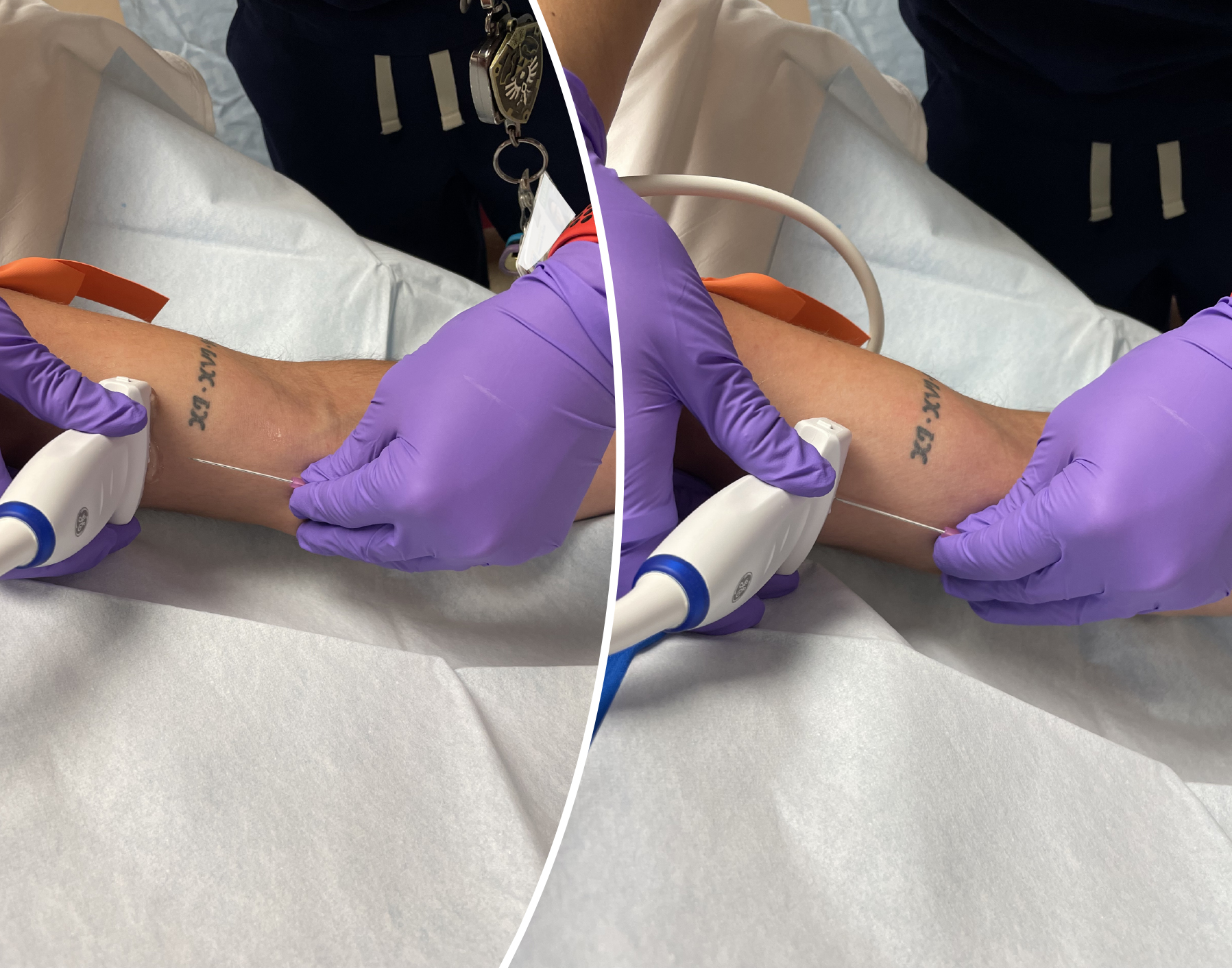 Radiology Management - July-Aug-2024 High-Level Disinfection (HLD): A ...