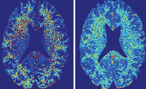 Science Magazine - March 22, 2019 Clever math enables MRI to map ...